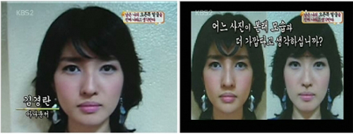 잘생긴 사람도 얼굴이 비대칭이다? | bnt뉴스